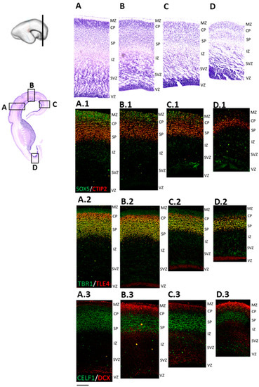 Early Regional Patterning in the Human Prefrontal Cortex Revealed by ...
