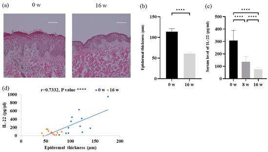 Effects of Dupilumab on Itch-Related Events in Atopic Dermatitis ...
