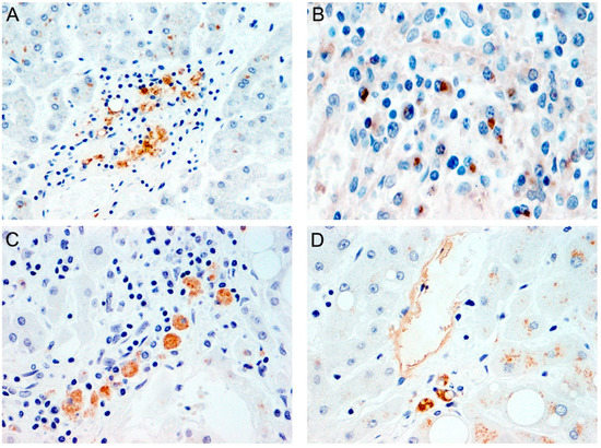 Pathogenesis and Mechanisms of SARS-CoV-2 Infection in the Intestine ...