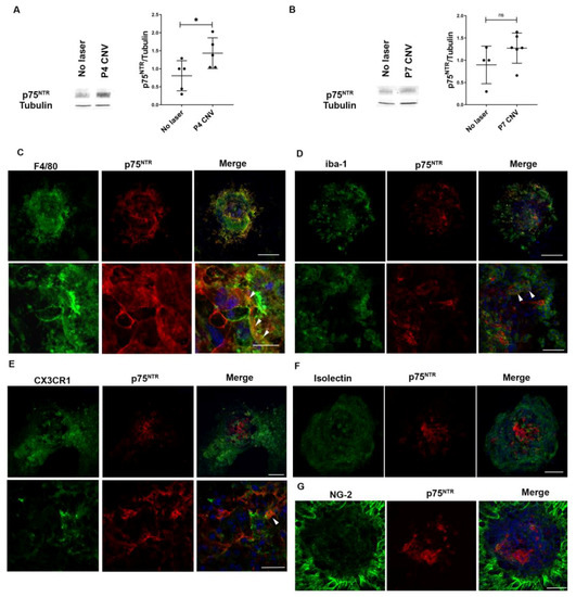 Etiological Roles of p75NTR in a Mouse Model of Wet Age-Related Macular ...