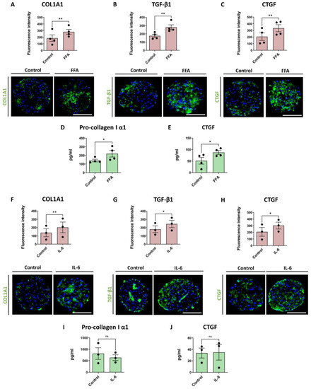 The Role of CTGF in Liver Fibrosis Induced in 3D Human Liver Spheroids