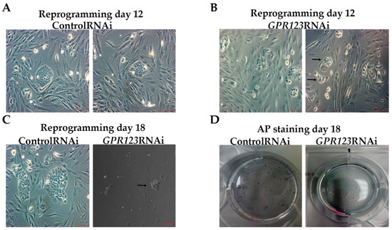 Essential Role of Adhesion GPCR, GPR123, for Human Pluripotent Stem ...