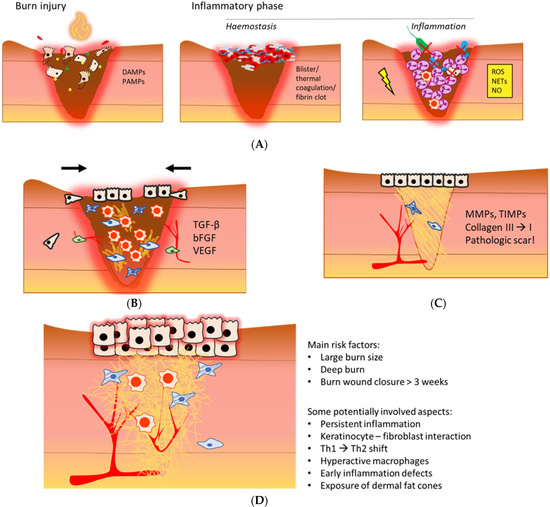 Cells | Free Full-Text | The Complexity of the Post-Burn Immune ... Cells | Free Full-Text | The Complexity of the Post-Burn Immune ...