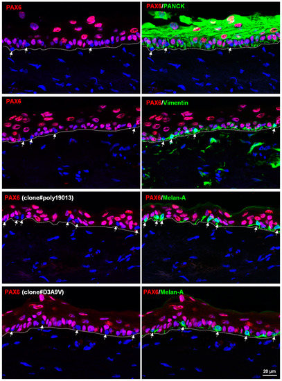 PAX6 Expression Patterns in the Adult Human Limbal Stem Cell Niche