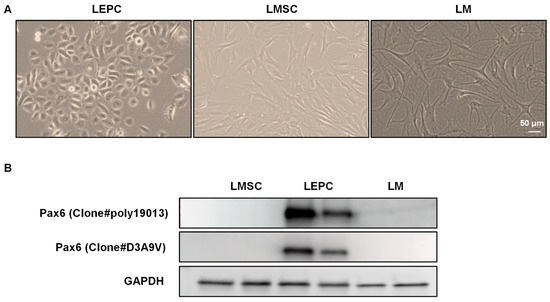 PAX6 Expression Patterns in the Adult Human Limbal Stem Cell Niche