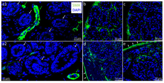 Germ Cell Maintenance and Sustained Testosterone and Precursor Hormone ...
