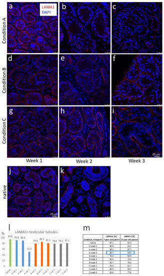 Germ Cell Maintenance and Sustained Testosterone and Precursor Hormone ...
