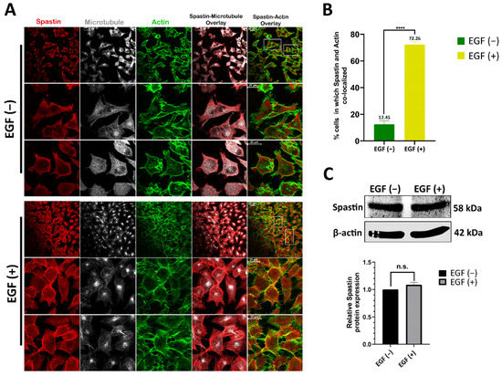 Spastin Promotes the Migration and Invasion Capability of T98G ...