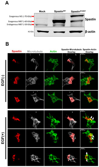 Spastin Promotes the Migration and Invasion Capability of T98G ...