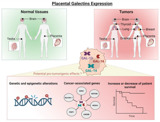 Placental Galectins in Cancer: Why We Should Pay More Attention