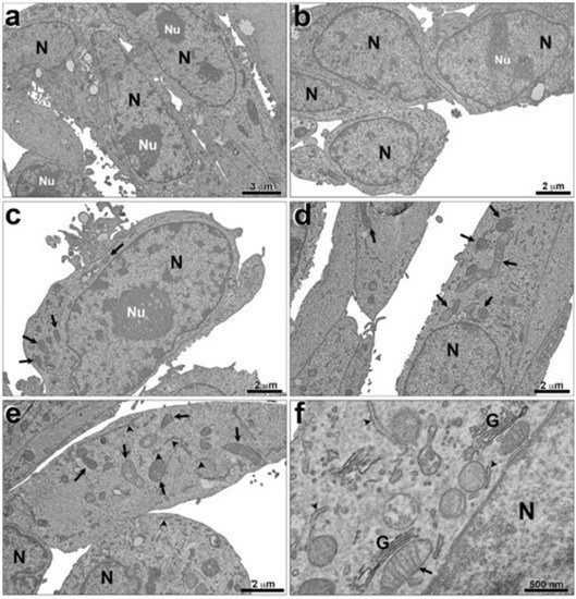 Ultrastructural Analysis of Cancer Cells Treated with the ...