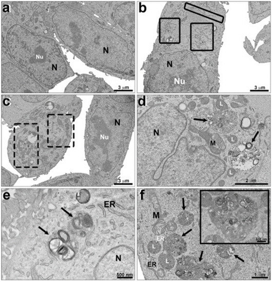 Ultrastructural Analysis of Cancer Cells Treated with the ...