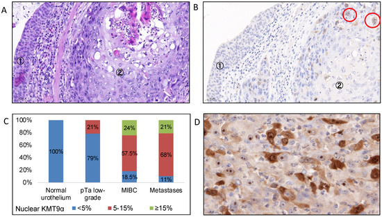 Cells | Free Full-Text | Overexpression of KMT9α Is Associated with ...
