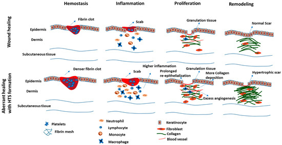 An Updated Review of Hypertrophic Scarring
