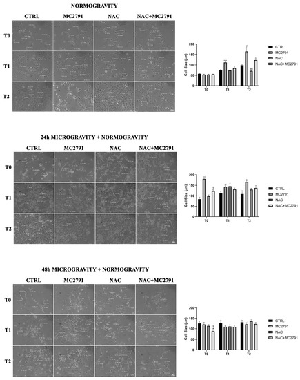 Role of SIRT3 in Microgravity Response: A New Player in Muscle Tissue ...