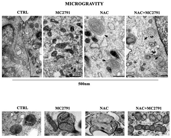Role of SIRT3 in Microgravity Response: A New Player in Muscle Tissue ...