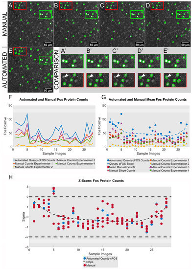 Quanty-cFOS, a Novel ImageJ/Fiji Algorithm for Automated Counting of Immunoreactive Cells in ...