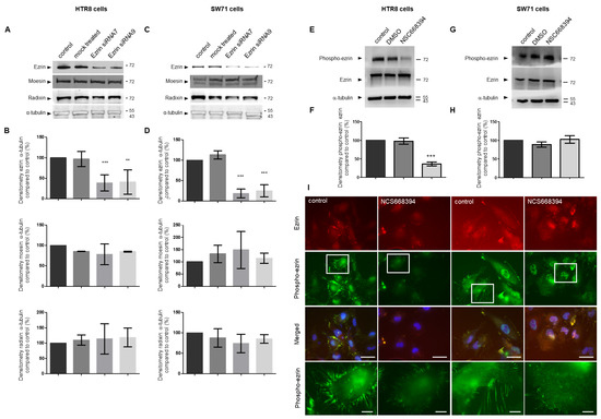 Ezrin and Its Phosphorylated Thr567 Form Are Key Regulators of Human ...