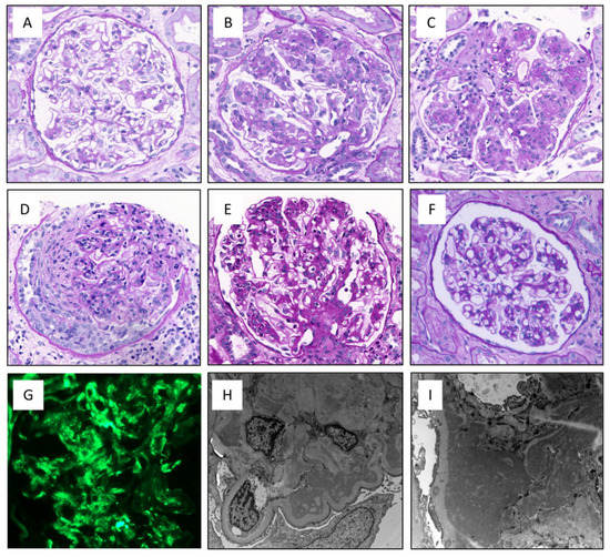 Diagnostic and Prognostic Comparison of Immune-Complex-Mediated ...