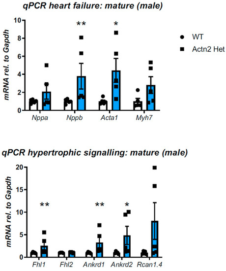 Insights into the Role of a Cardiomyopathy-Causing Genetic Variant in ACTN2