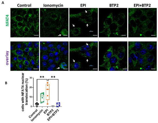 Blocking Store-Operated Ca2+ Entry to Protect HL-1 Cardiomyocytes from ...