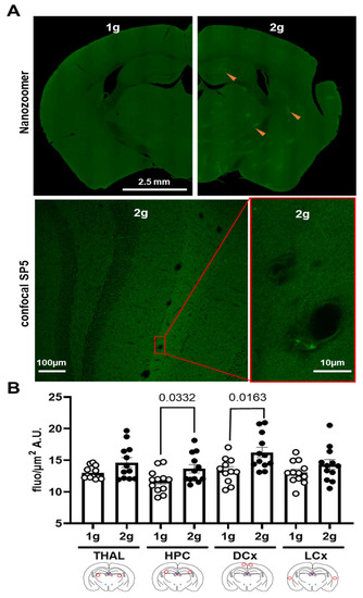Cells | Free Full-Text | Hypergravity Increases Blood–Brain Barrier ...