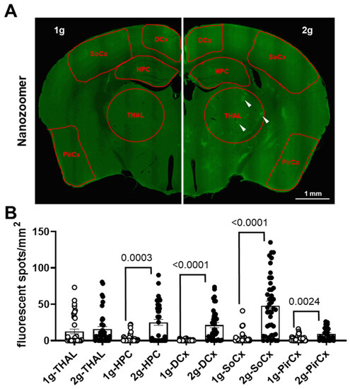 Hypergravity Increases Blood–Brain Barrier Permeability to Fluorescent ...