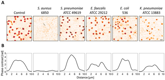 Application of Digital Holographic Microscopy to Analyze Changes in T ...
