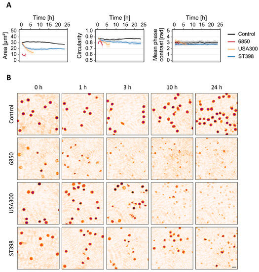 Application of Digital Holographic Microscopy to Analyze Changes in T ...