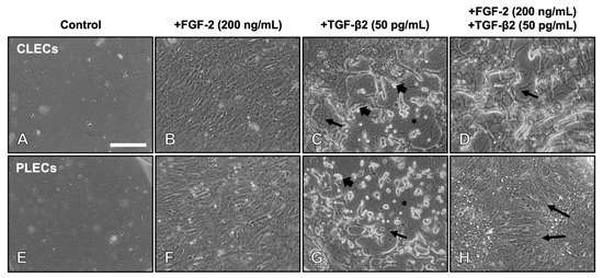 FGF-2 Differentially Regulates Lens Epithelial Cell Behaviour during ...