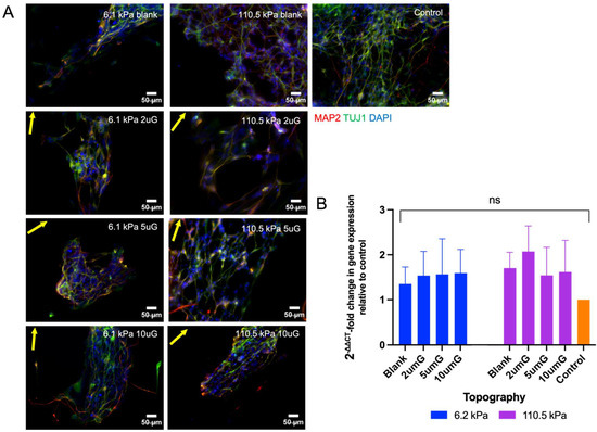 The Combined Effects of Topography and Stiffness on Neuronal ...