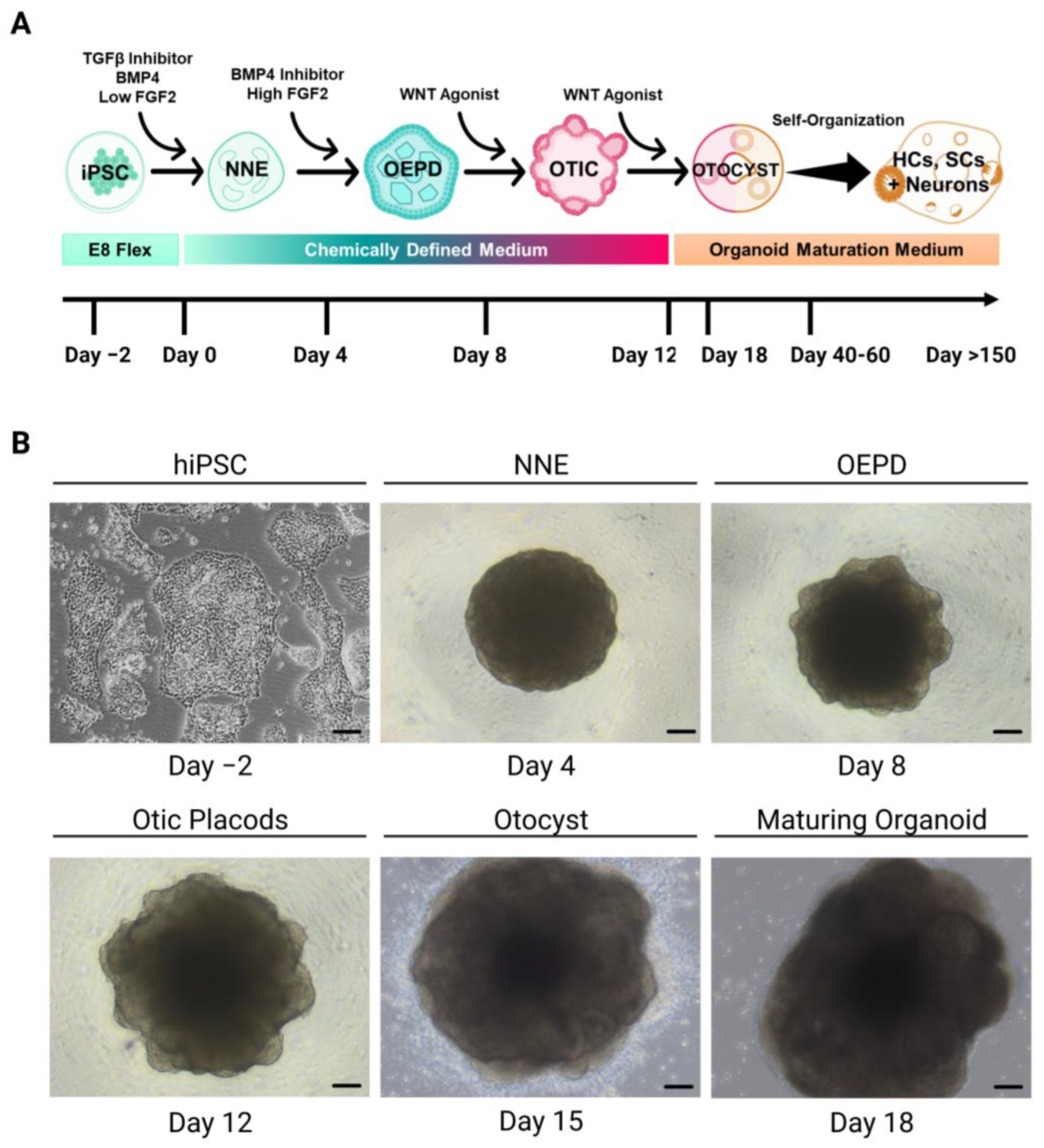 Application of Human Stem Cells to Model Genetic Sensorineural Hearing ...