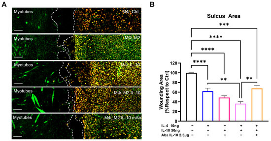 Cells | Free Full-Text | Intramuscular IL-10 Administration Enhances ...