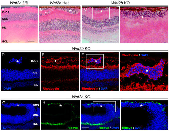 Ectopic Rod Photoreceptor Development in Mice with Genetic Deficiency ...