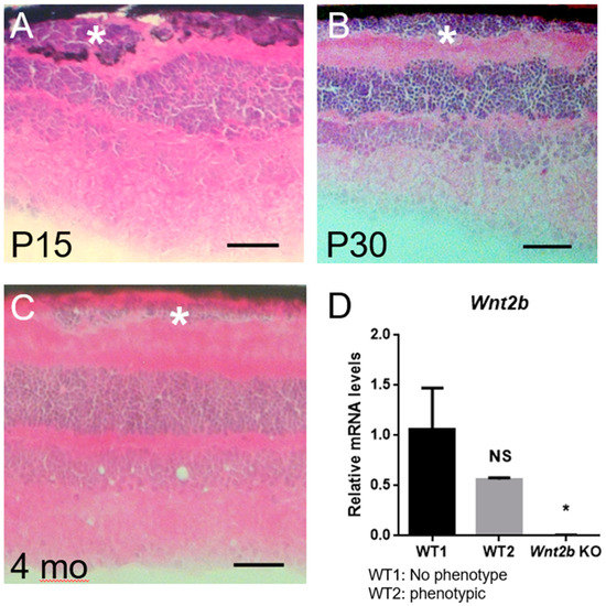 Ectopic Rod Photoreceptor Development in Mice with Genetic Deficiency ...
