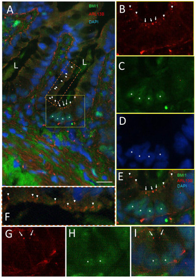 Primary Cilium Identifies a Quiescent Cell Population in the Human ...