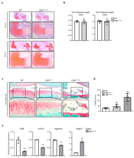Cbfβ Is a Novel Modulator against Osteoarthritis by Maintaining ...
