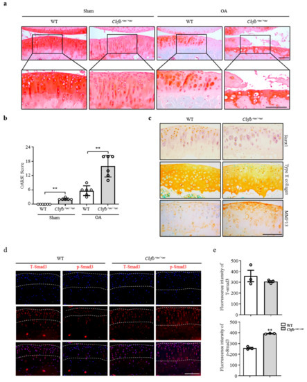 Cbfβ Is a Novel Modulator against Osteoarthritis by Maintaining ...