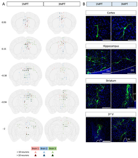 Developmental Changes of Human Neural Progenitor Cells Grafted into the ...