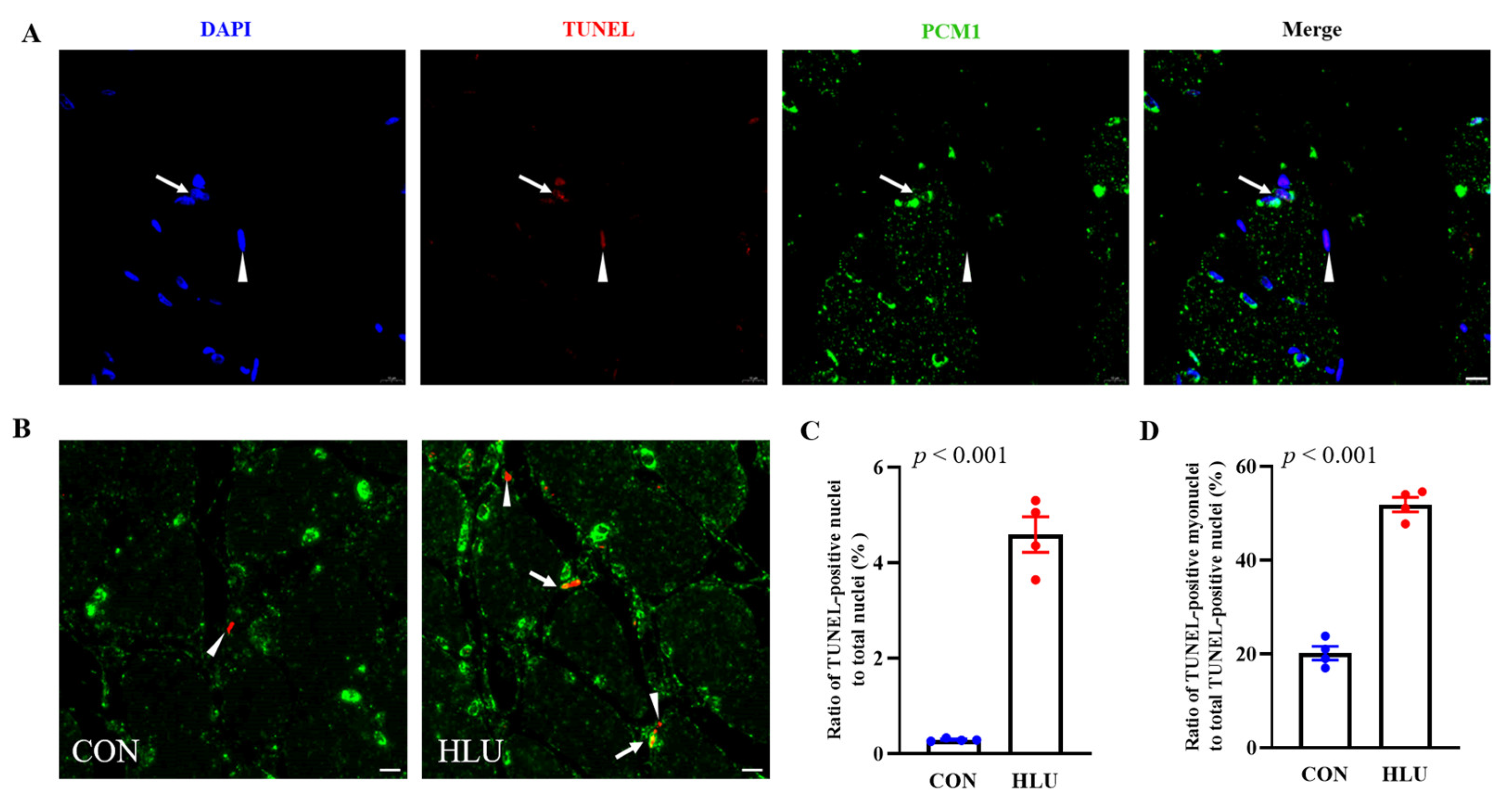 New Findings: Hindlimb Unloading Causes Nucleocytoplasmic Ca2+ Overload ...