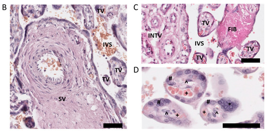 Integrated Placental Modelling of Histology with Gene Expression to ...