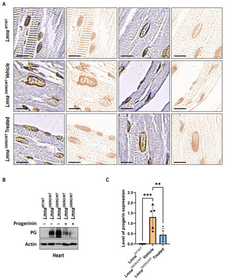 Progerinin, an Inhibitor of Progerin, Alleviates Cardiac Abnormalities ...