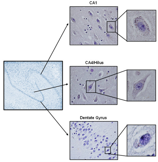 Postmortem Brains from Subjects with Diabetes Mellitus Display Reduced ...