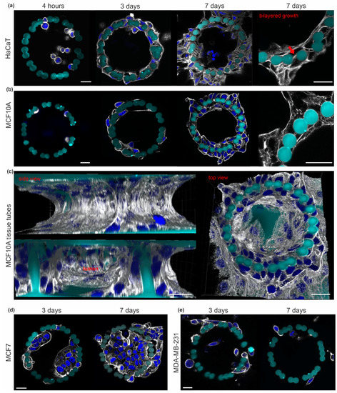 Elastomeric Pillar Cages Modulate Actomyosin Contractility of ...