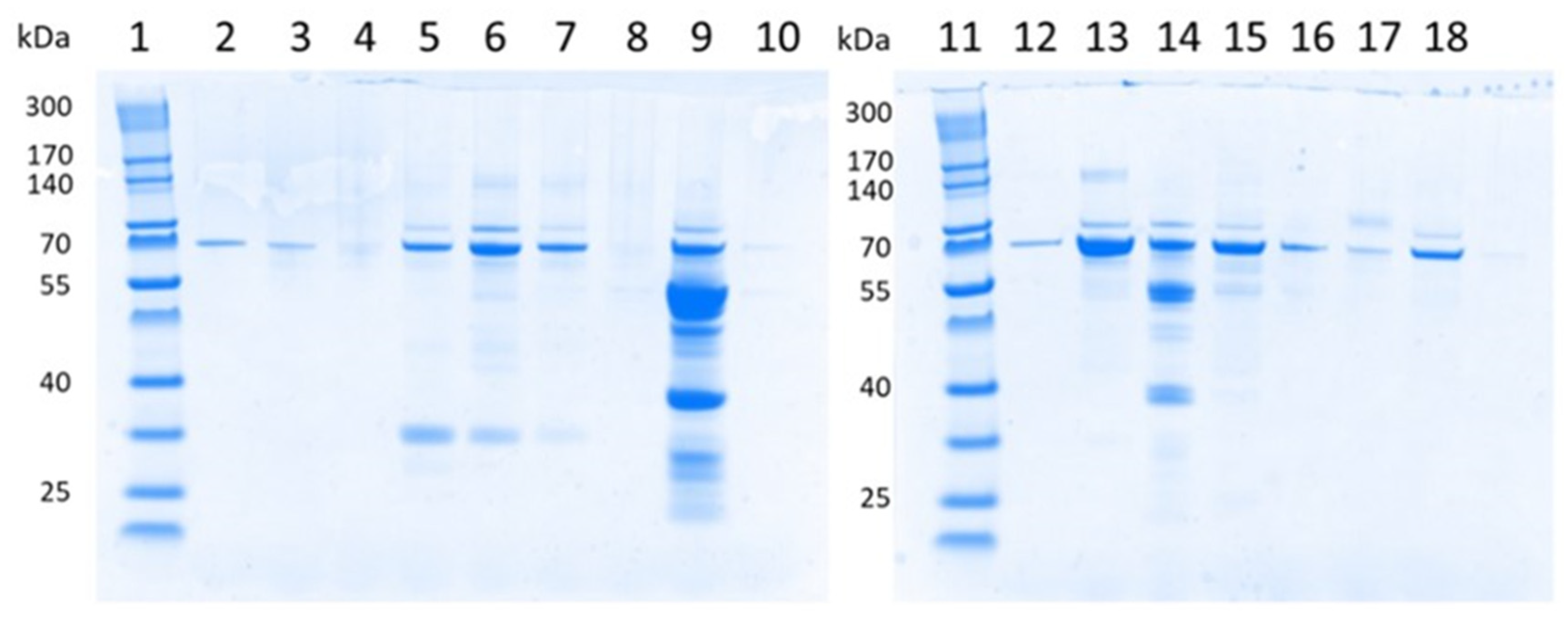 Ratio of Urinary Proteins to Albumin Excretion Shifts Substantially ...