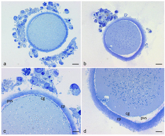 Effects of Simulated Microgravity In Vitro on Human Metaphase II ...