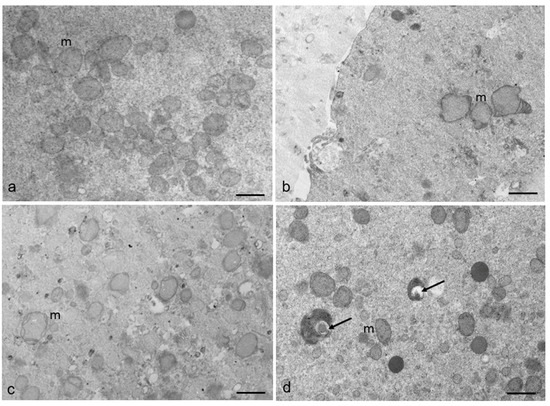 Effects of Simulated Microgravity In Vitro on Human Metaphase II ...
