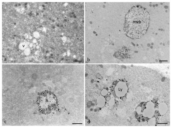 Effects of Simulated Microgravity In Vitro on Human Metaphase II ...