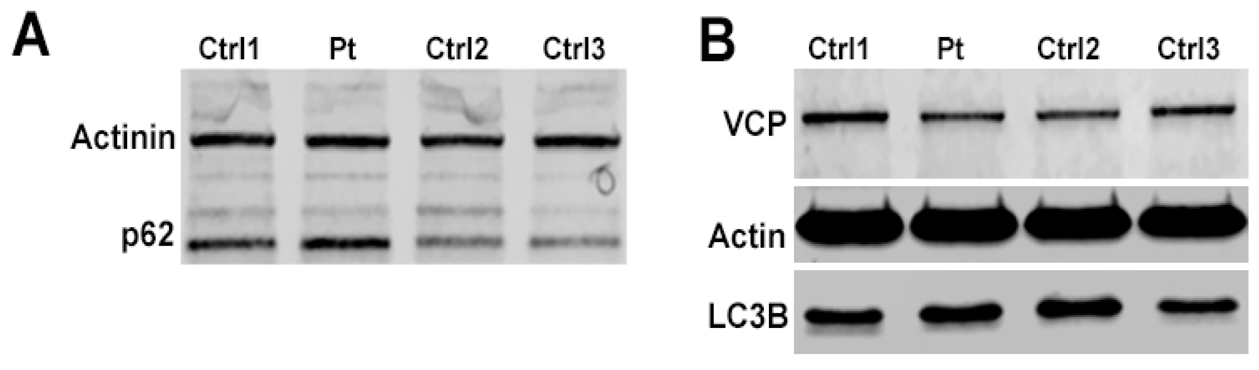 Cells | Free Full-Text | Characterization of Skeletal Muscle Biopsy and ...