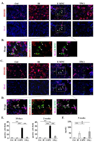 Immunomodulatory Macrophages Enable E-MNC Therapy for Radiation-Induced ...